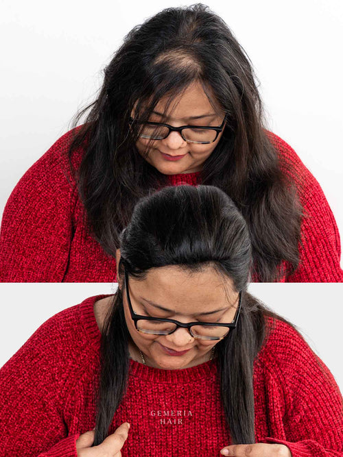 Shop Invisible Side Patches | Side Patches Hair Extensions - Gemeria Hair