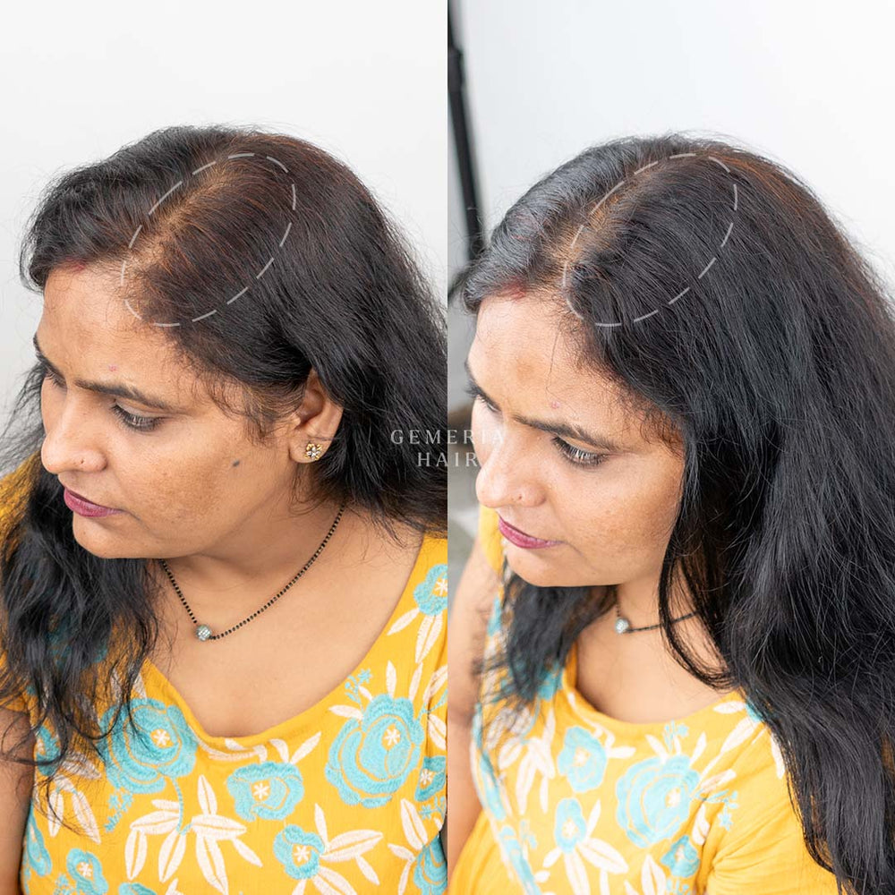 Invisible Hair Patches & Cover-Ups | Gemeria Hair